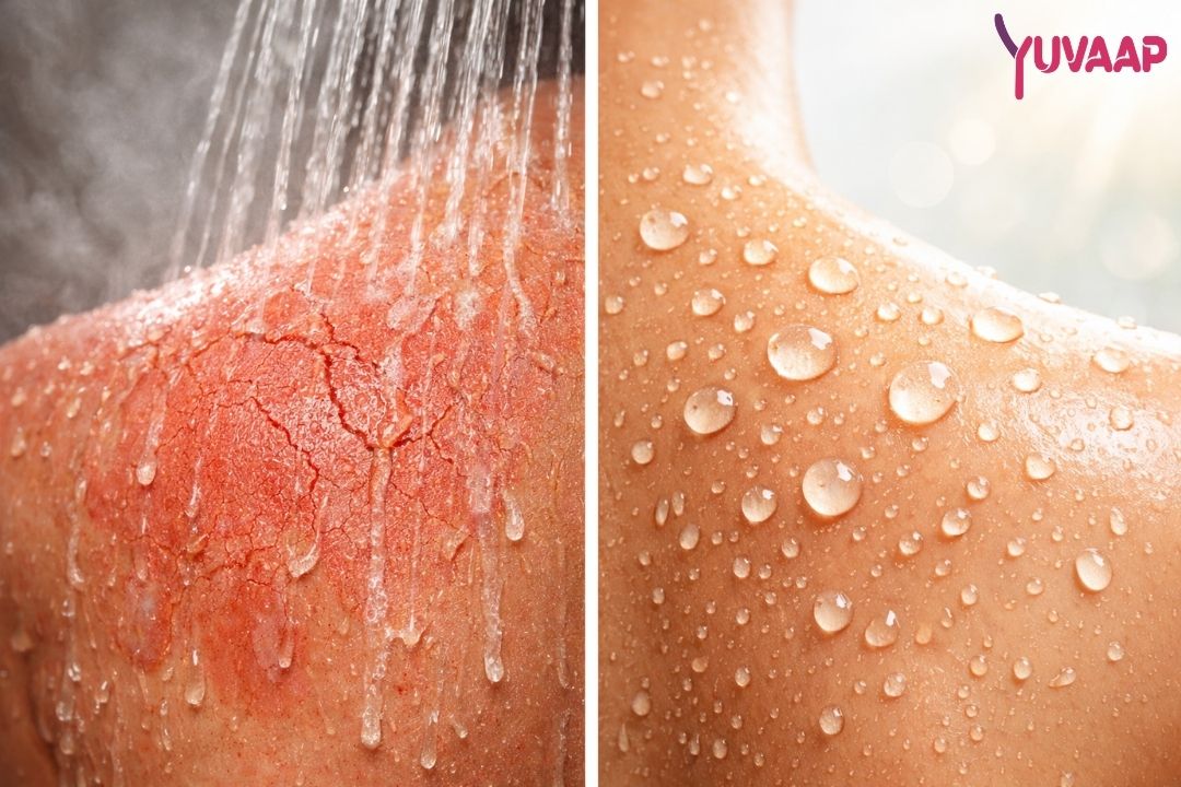 Does Hot Water Damage Your Skin Barrier? - Yuvaap - #FindYourY